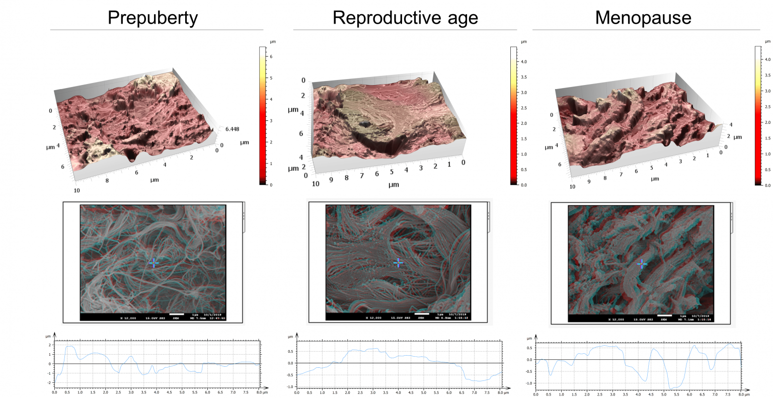 Using 3D reconstruction of SEM images to reverse-engineer the human ...