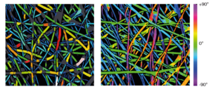 Welcome to the fascinating world of fiber analysis - Digital Surf